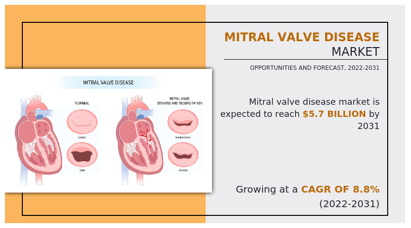 Mitral Valve Disease Market | Global Opportunity Analysis and Industry