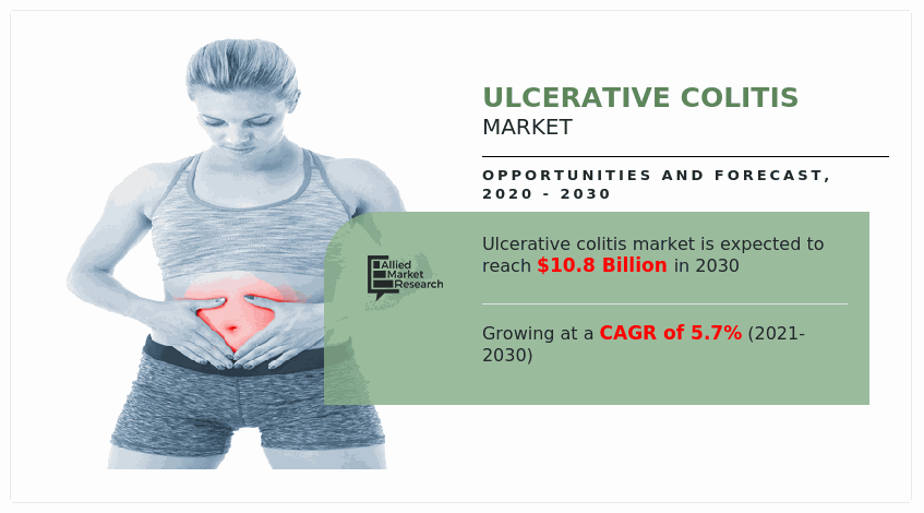 Ulcerative Colitis Market Statistics, Segments | Forecast - 2030