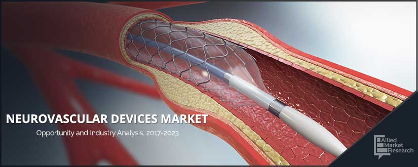 Neurovascular Devices Market Size, Share | Industry Growth, 2023