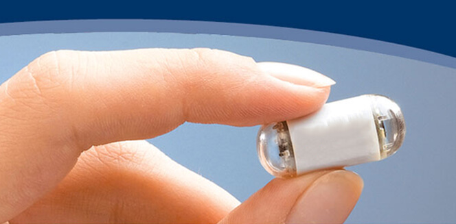 Technology advancements in capsule endoscopy system promise early ...