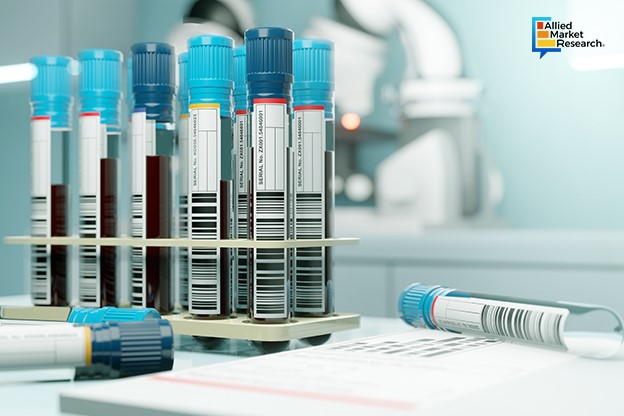 How are rapid diagnostic tests kits revolutionizing the blood screening ...