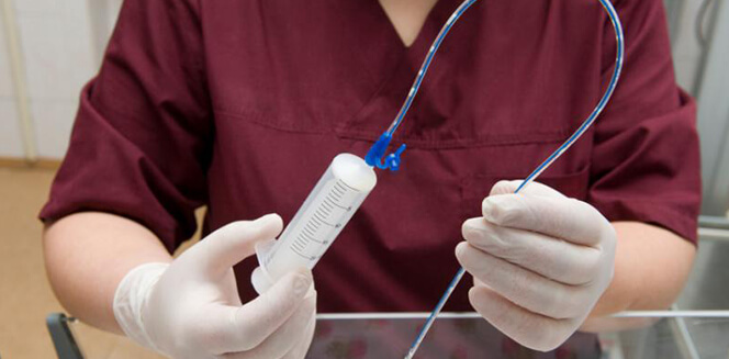 Stringent Regulations to Drive Enteral Feeding Devices Worldwide