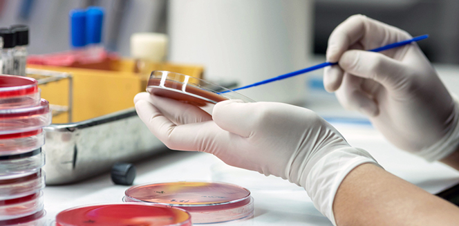 Blood Culture Test New Product Launches and Approvals to Help Combat ...