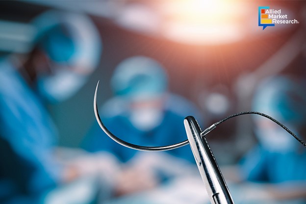 Breakthroughs in Surgical Suture Materials: Revolutionizing Healthcare ...