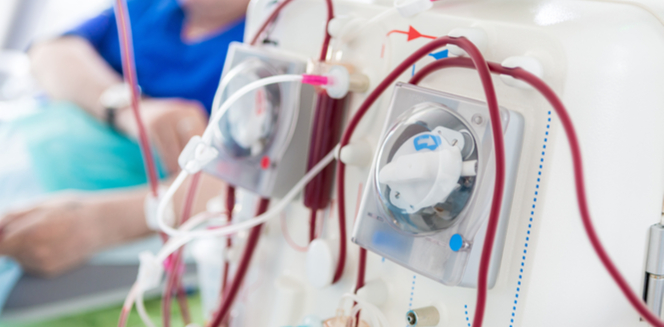 Revolutionizing Home Dialysis: Innovative Systems Enhancing Patient Lives