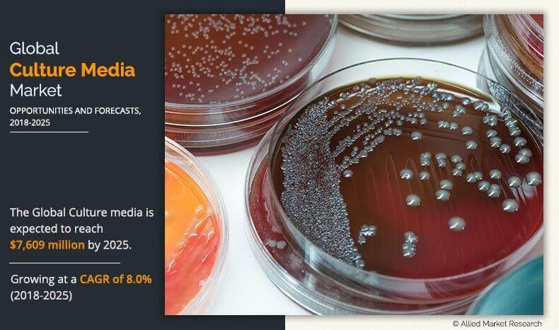 Culture Media Market Size, Share and Industry Analysis by 2025 | AMR